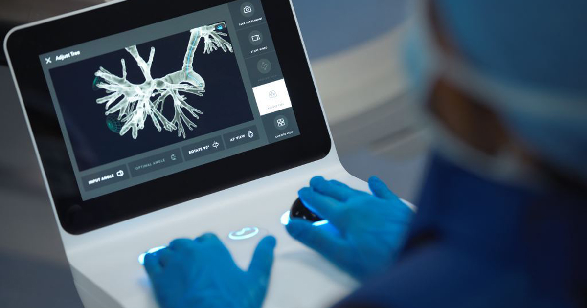 El Camino Health is First in the World to Commercially Offer Robotic ...