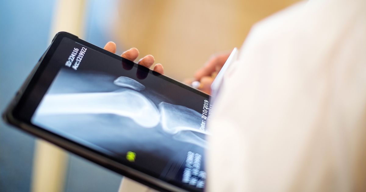 Bringing Technology into Orthopedics | El Camino Health