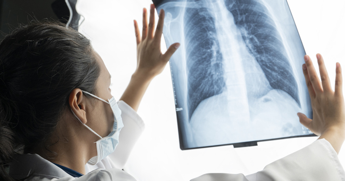 Protect Your Lungs: Lung Cancer Screening & Management | El Camino Health