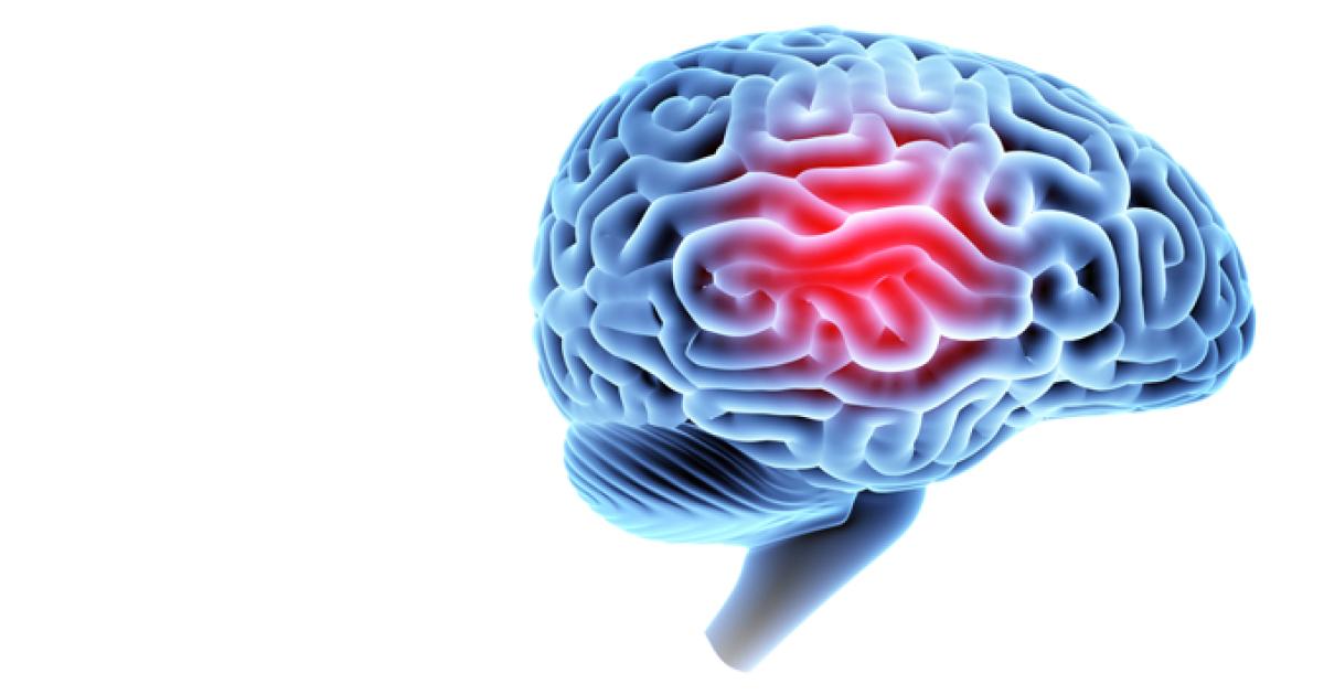Concussions: A Minor Head Injury Can Have Major Repercussions | El ... Concussions: A Minor Head Injury Can Have Major Repercussions | El ...