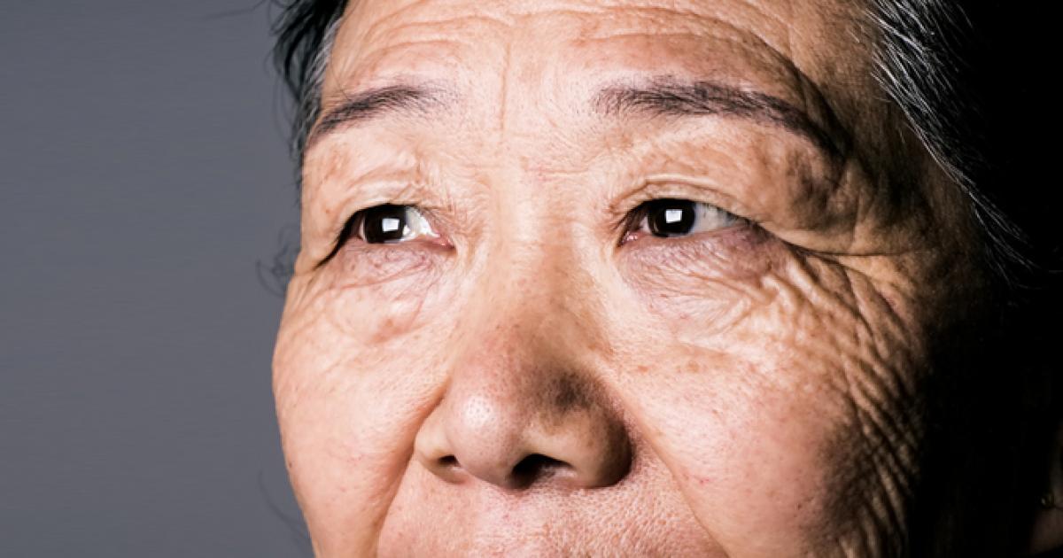 請問專家: 東方人的皮膚保健與護理 (Ask-the-Expert: Asian Skin Care) | El Camino Health